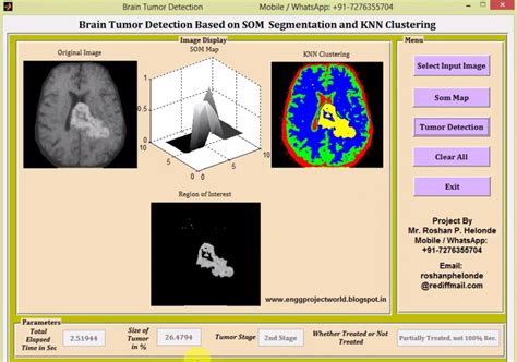 brain tumor detection using som segmentation and k clustering matlab project with source code