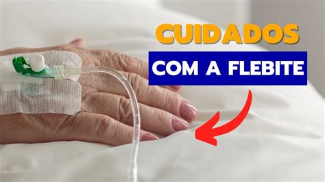 FLEBITE E OS CUIDADOS DE ENFERMAGEM YouTube