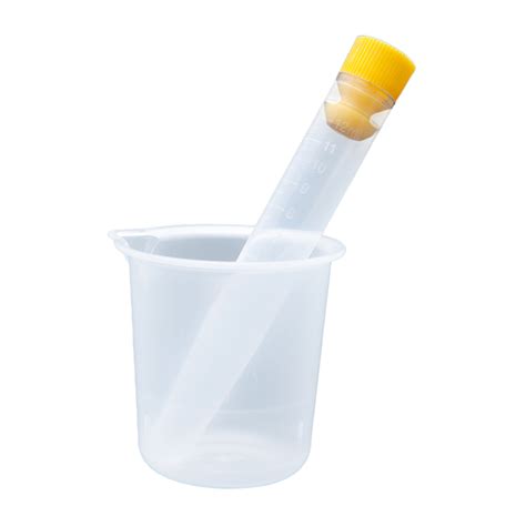 Kit Urina Est Ril Tubos Amarelo Vermelho Ml Becker Jprolab