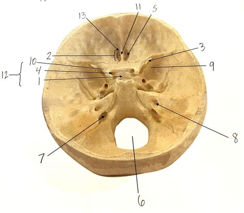 Superior View Of Skull Diagram Quizlet