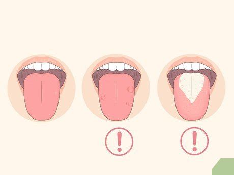 C Mo Limpiar Bien La Lengua Pasos Con Im Genes