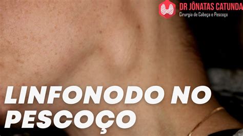 Linfonodo no pescoço que surgiu do nada YouTube