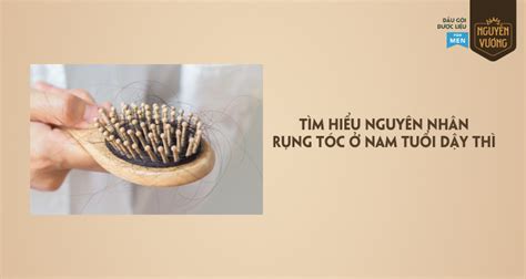 14 Nguyên nhân gây rụng tóc nhiều ở nam tuổi dậy thì và cách khắc phục