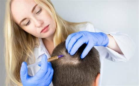 Alopecia Causada Por Estr S Tratamiento Grupo Milenio