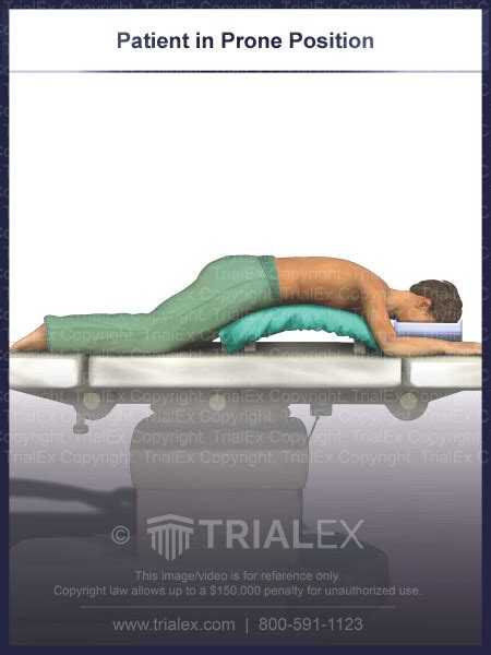 Patient In Prone Position Trial Exhibits Inc