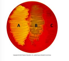 Micro Biology Lab Final Prep Flashcards Quizlet
