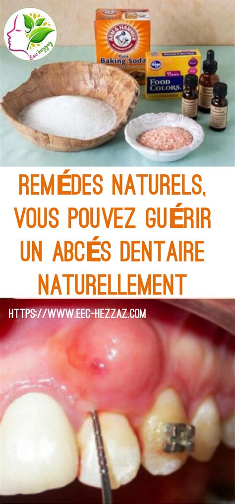 Remèdes naturels vous pouvez guérir un abcès dentaire naturellement