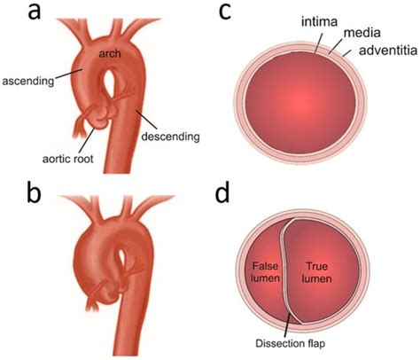 IJMS Free Full Text Is There Enough Evidence To Support The Role Of