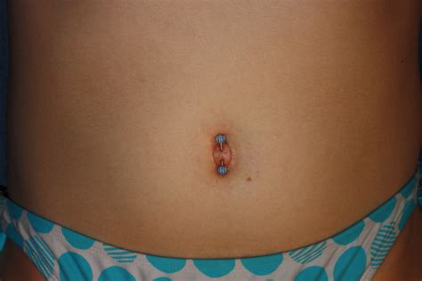 Innie Belly Button Outie Belly Button Causes More Atelier Yuwa Ciao Jp