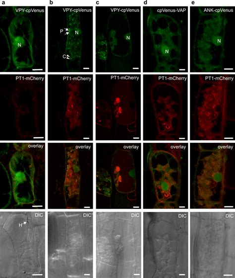 Subcellular Localization Of Full Length VPY VAP MSP And Ankyrin