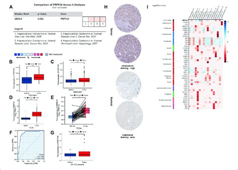 The MRNA And Protein Expression Of PRPF19 In Liver Cancer A C