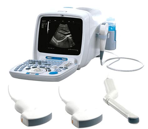 ULTRASONIDO C30 CON 1 TRANSDUCTOR CONVEXO GALERÍA MEDICA