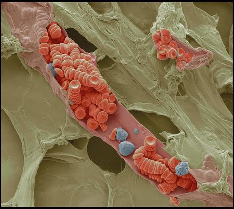 Red And White Blood Cells Inside A Small Blood Vessel Are Captured By A