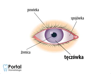 Zapalenie tęczówki Portal Stomatologa