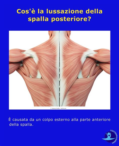 Lussazione Della Spalla I Sintomi Le Complicanze E Gli Esami Pi