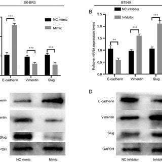 Overexpression Of MiR 217 5p Prevents The Epithelial Mesenchymal