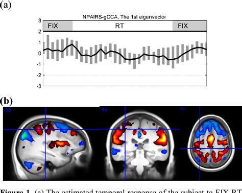 figure 1 from spatiotemporal fmri data processing using generalized canonical correlation