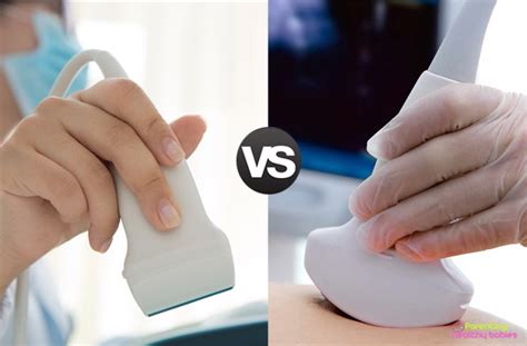Ultrasonography Vs Ultrasound