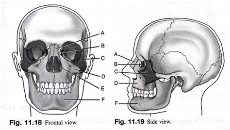 Chapter 11 Cranium Facial Bones And Paranasal Sinuses Part C
