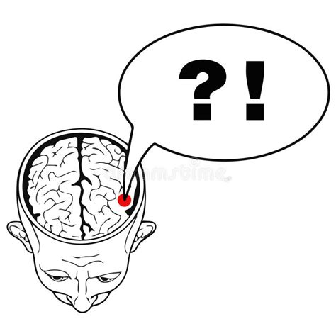 Vista Superior Del Cerebro Humano En La Mente Interrogante De La Cabeza