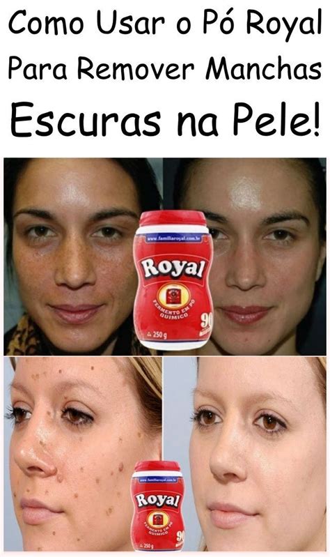 Como usar o pó royal para remover manchas escuras nas pele Artofit