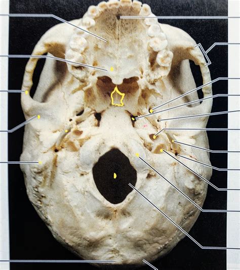 Inferior View Of Skull Diagram Quizlet