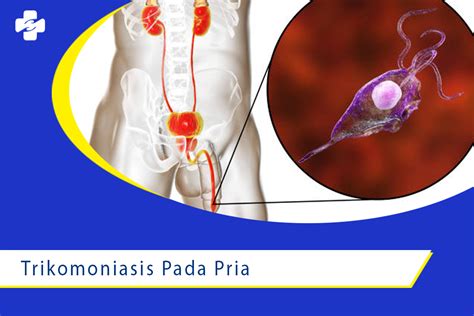 Mengetahui Gejala Trikomoniasis Pada Pria Klinik Utama Sentosa