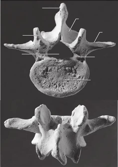 Lumbar Vertebral Features Diagram Quizlet
