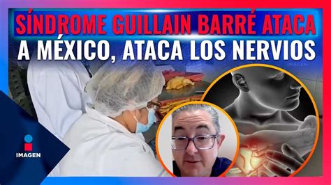 Qu Es El S Ndrome Guillain Barr Y Cu Les Son Sus Consecuencias
