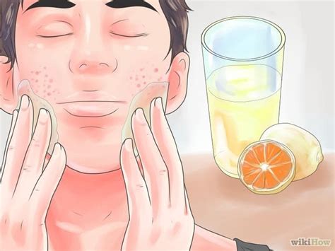 Comment se débarrasser des cicatrices dacné une fois pour toutes