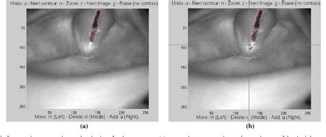 figure 8 from automatic glottal segmentation using local based active contours and application