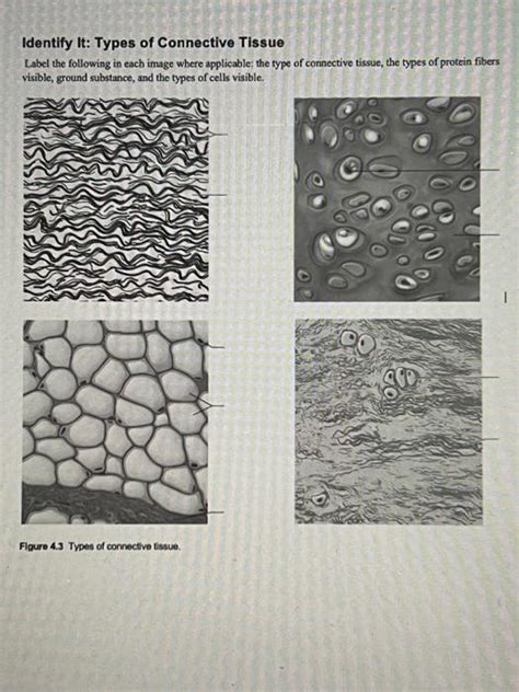 Solved Identify Types Of Connective Tissuelabel The Follo