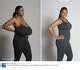 Rare Condition Causes Texas Woman To Undergo Reduction For 36NNN Breasts