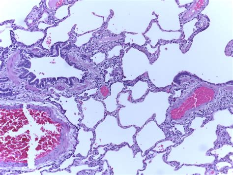 Lung Histology Diagram Quizlet