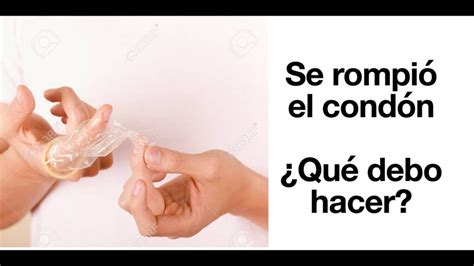 Se rompió el condón Descubre qué hacer para prevenir el VIH