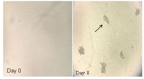 Representative Images Of Colonies Formed In Soft Agar By Pari ICR At