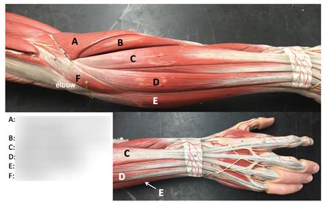Muscles Of The Lower Arm Lab Model Diagram Quizlet