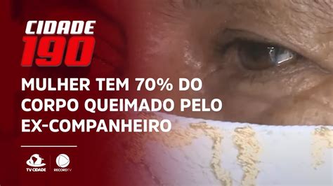 Mulher Tem 70 Do Corpo Queimado Pelo Ex Companheiro YouTube