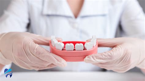 Qué Es El Curetaje Dental Clínica Dental Arco