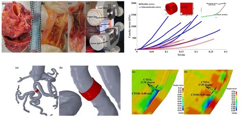 numerical modeling of the atherosclerosis ls dyna tutorials ls dyna examples