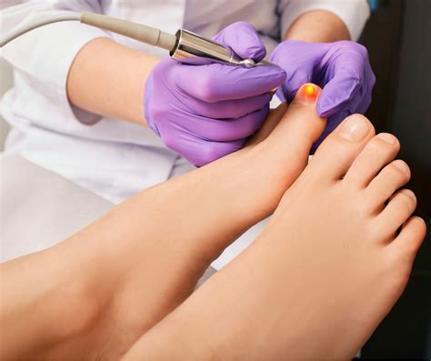 Spotting And Stopping Toenail Fungus PodiatryCare P C And The Heel