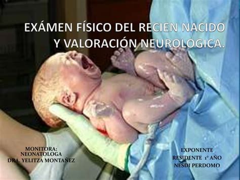 EXÁMEN FÍSICO DEL RECIEN NACIDO Y VALORACIÓN NEUROLOGICA pptx