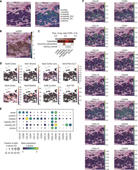 Spatial Transcriptomics Elucidates Medulla Niche Supporting Germinal