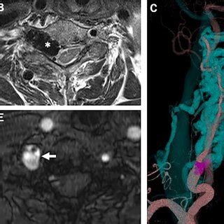 Magnetic Resonance Imaging And Computed Tomography Angiography A