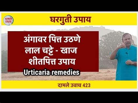 अगवर पतत उठण लल चटट खज शतपतत उपय allergic rash