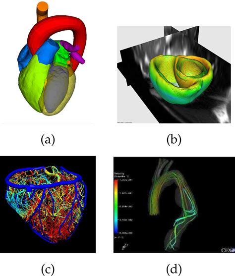 euheart integrated cardiac care using patient specific cardiovascular modeling spie homepage