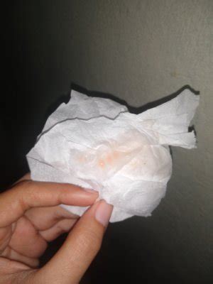Topo 94 Imagem Corrimento Rosa Pode Ser Gravidez Br Thptnganamst Edu Vn