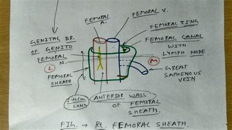 Femoral Sheath