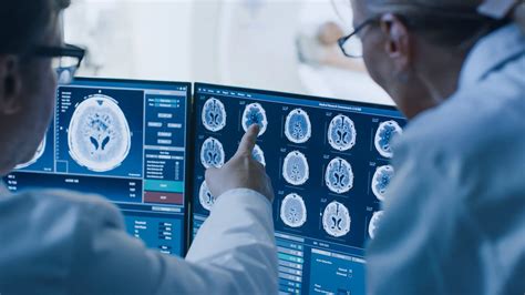Tumor cerebral saiba como lidar a doença Padrão