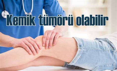Kemik Tümörleri ve Tedavisi